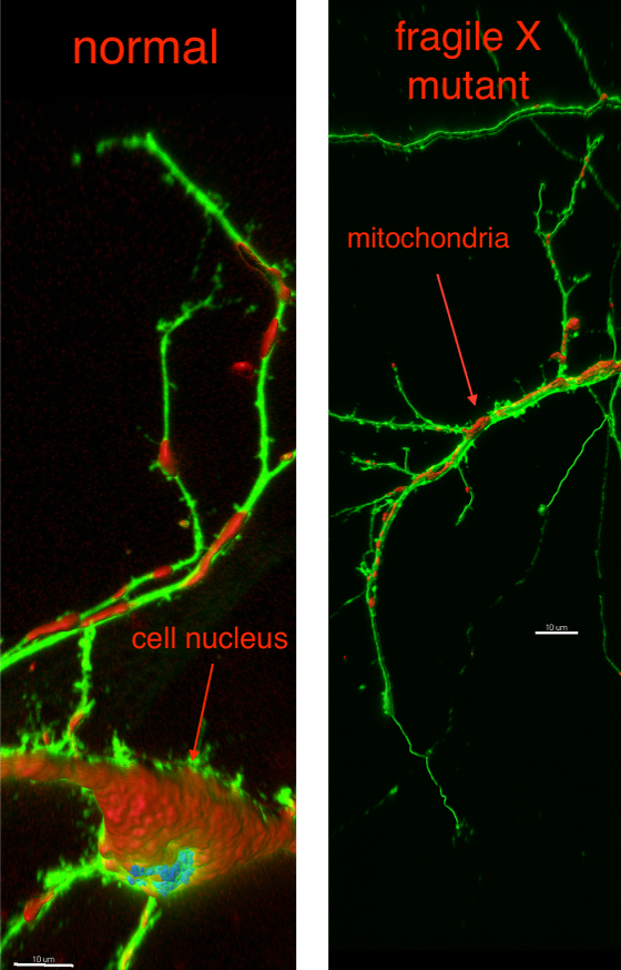 Cell component breakdown suggests possible treatment for multiple ...