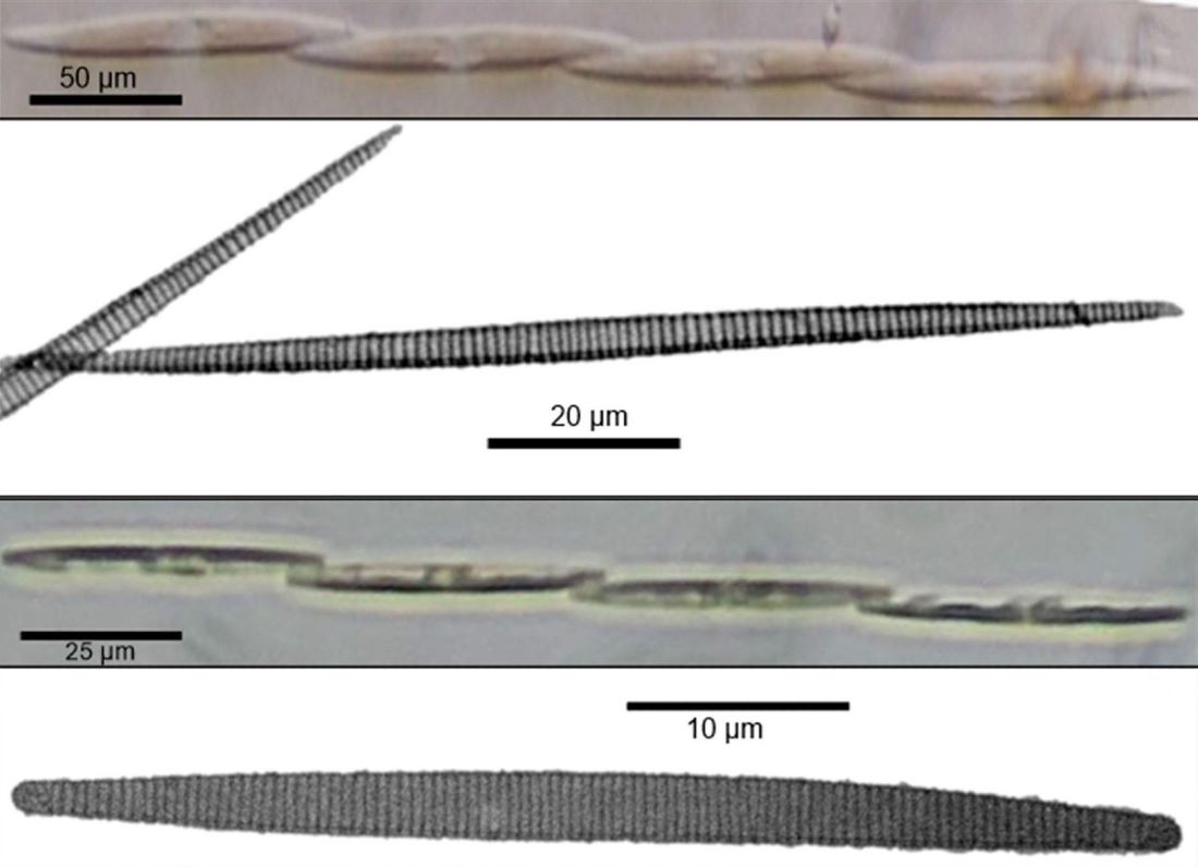 Two Pseudo-nitzschia diatom species identified in Luzon